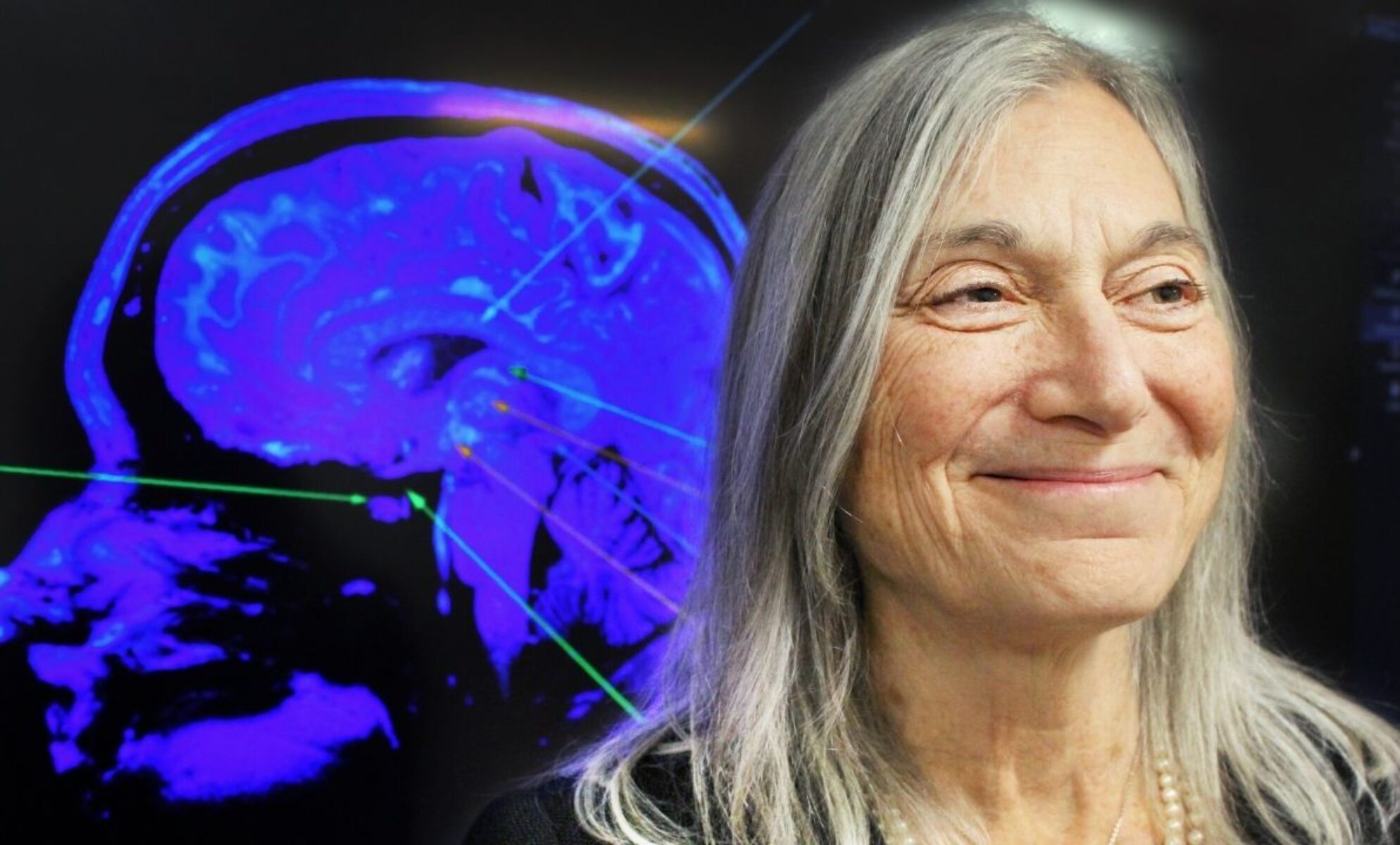 Ensuring Sex & Gender Representation in Dementia Research