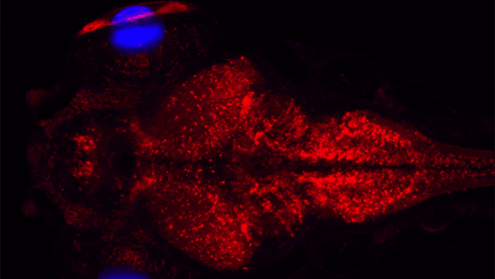 Epilepsy - Brain Canada Foundation