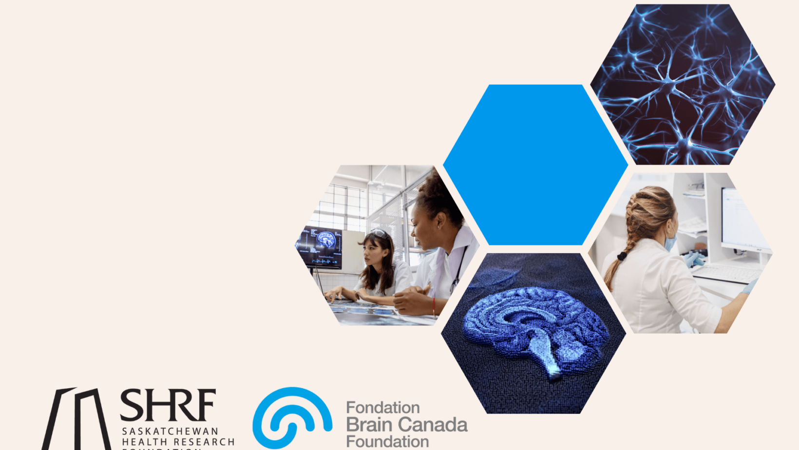 Brain Canada - Donate to support bold science for brain health